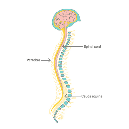 Transverse Myelitis - Treatments and Symptoms - AUTOIMMUNE SISTERS